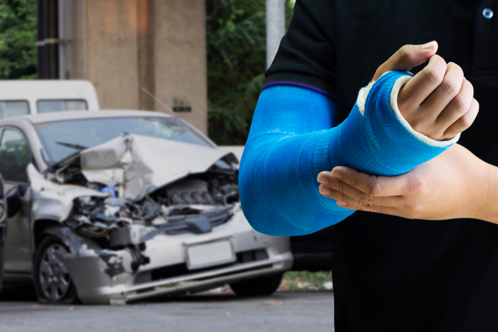 Arm Injuries from Car Accidents - Common Injuries